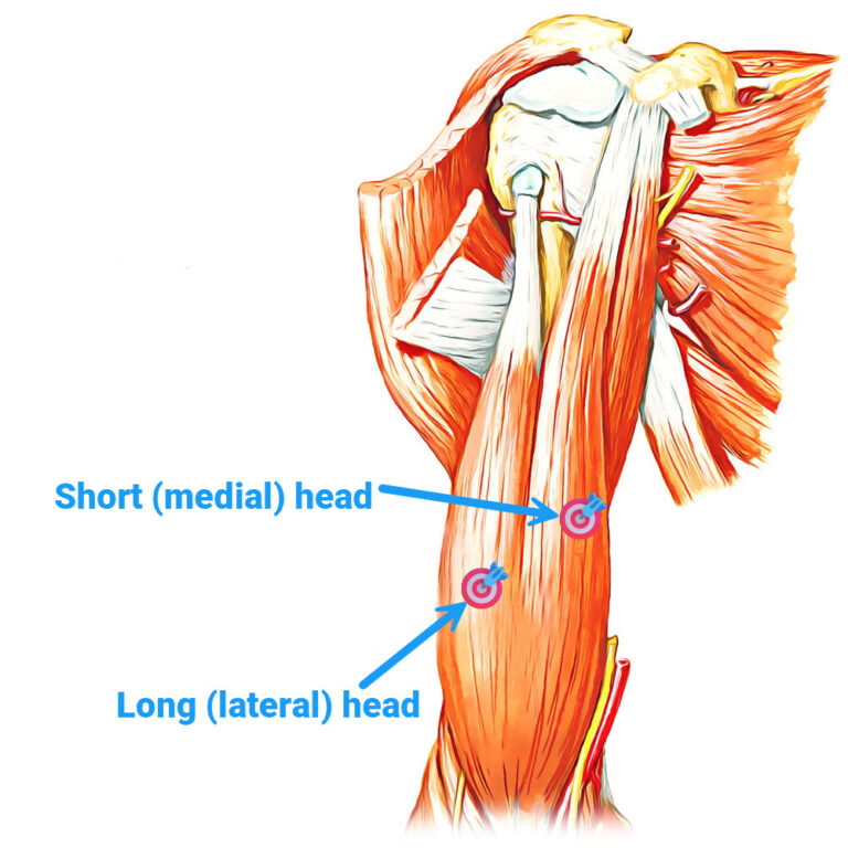 Mediphorm Ultra | IASP USA-Lite